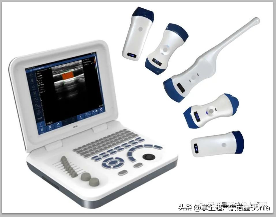 Sonostar Wireless Handheld Ultrasound Series - iNEWS