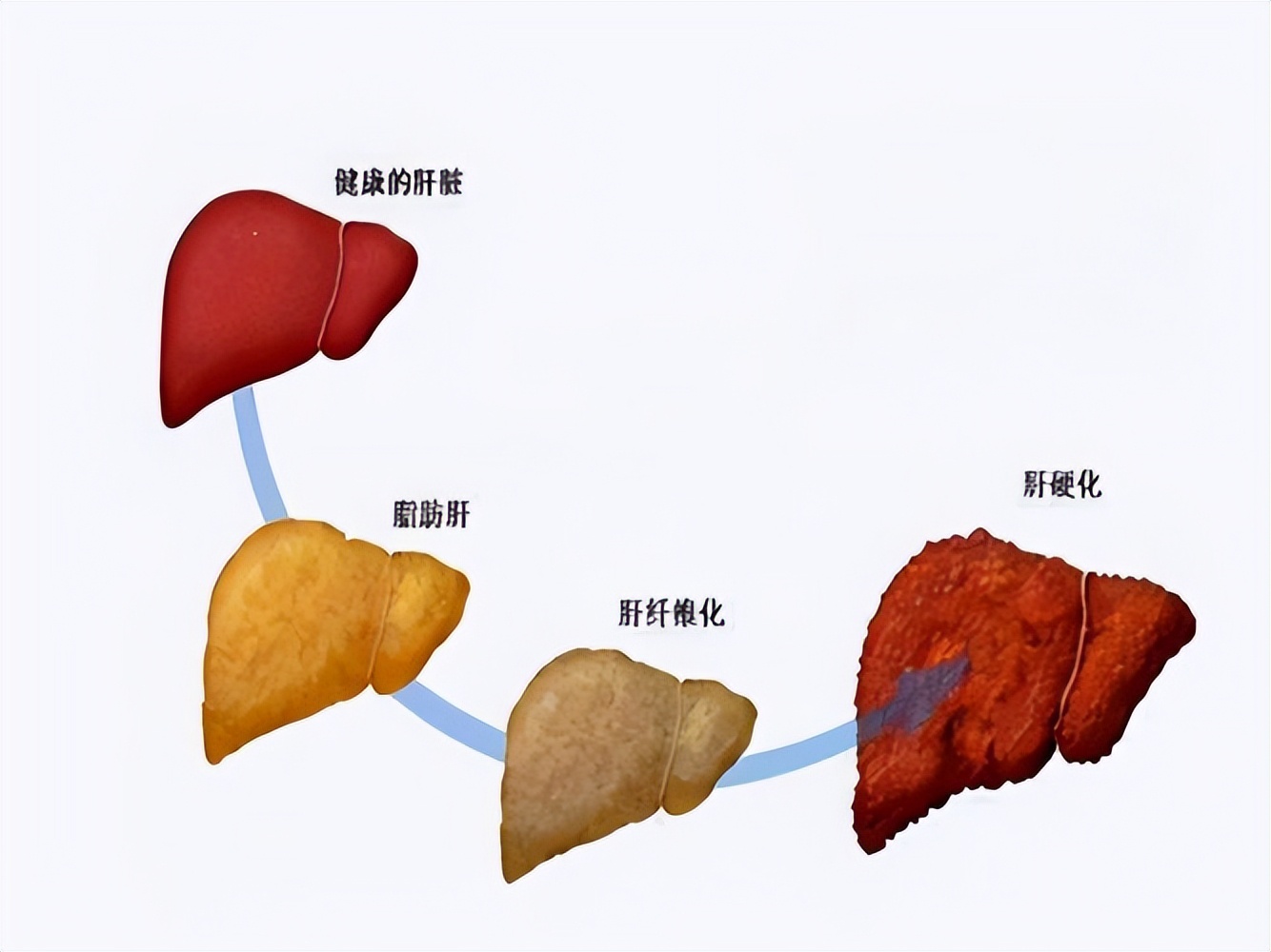 Bad liver, "face" prophet? Doctor: If there are three abnormalities on ...