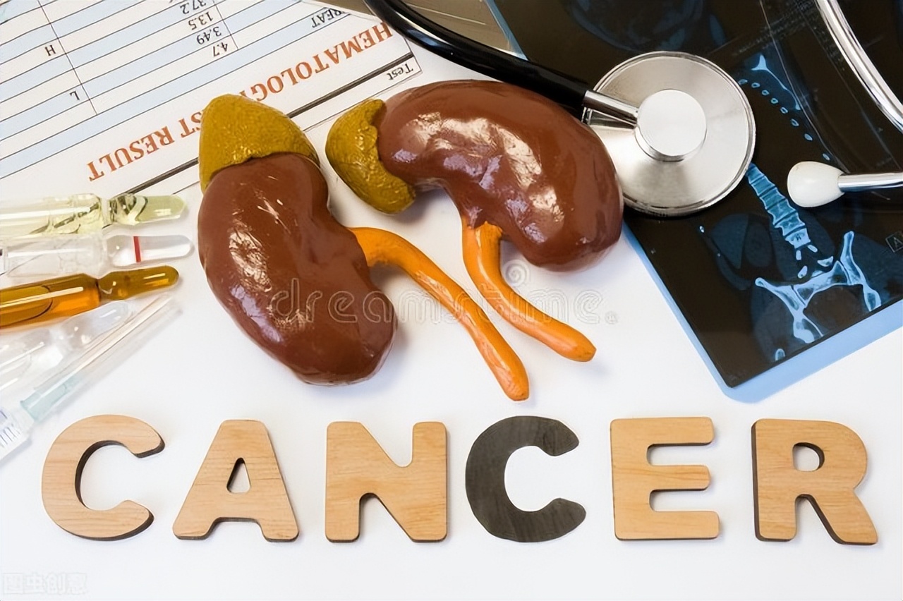 What are the preventive measures for kidney cancer? - iNEWS