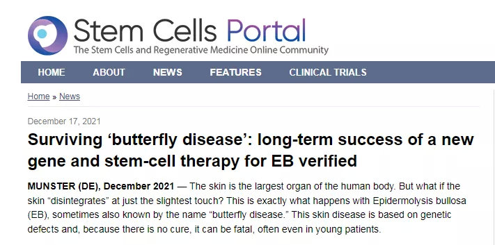 Stem cells rescue unbeautiful "butterfly disease" and keep skin stable ...