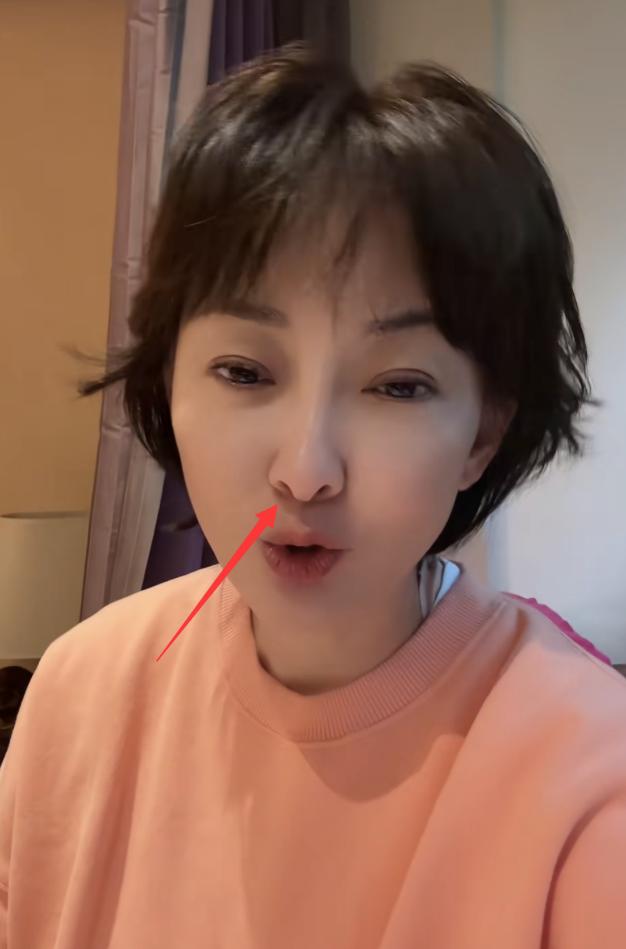 49-year-old Niu Li's plastic surgery has changed a lot, her face is ...