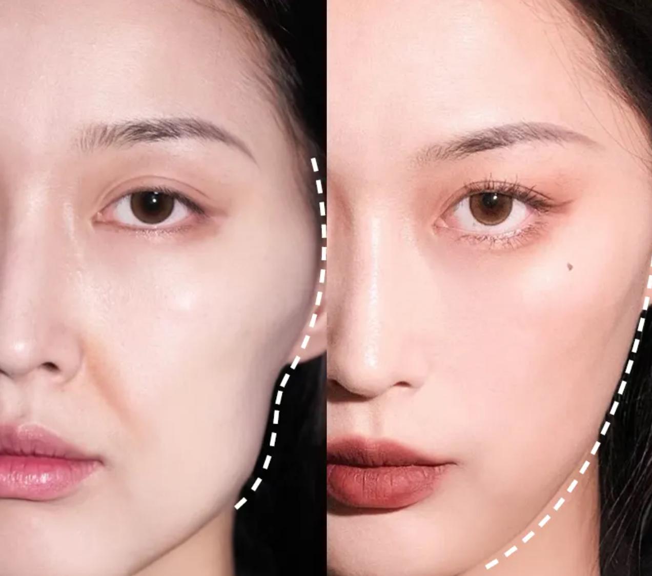 What to do if these 3 aging phenomena appear on the face: sunken ...