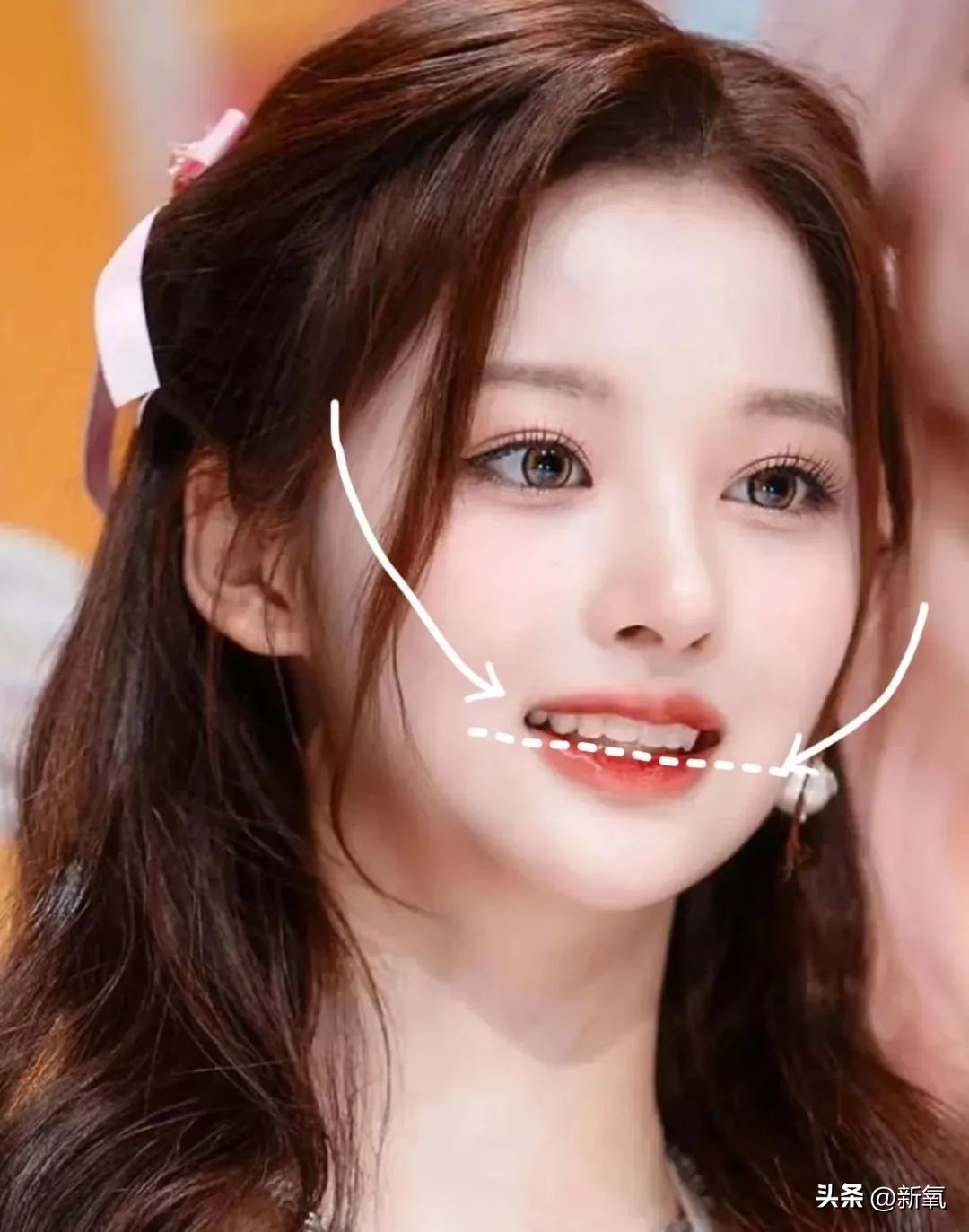 Xue Yun's orthodontics contrast before and after! Why do celebrities ...