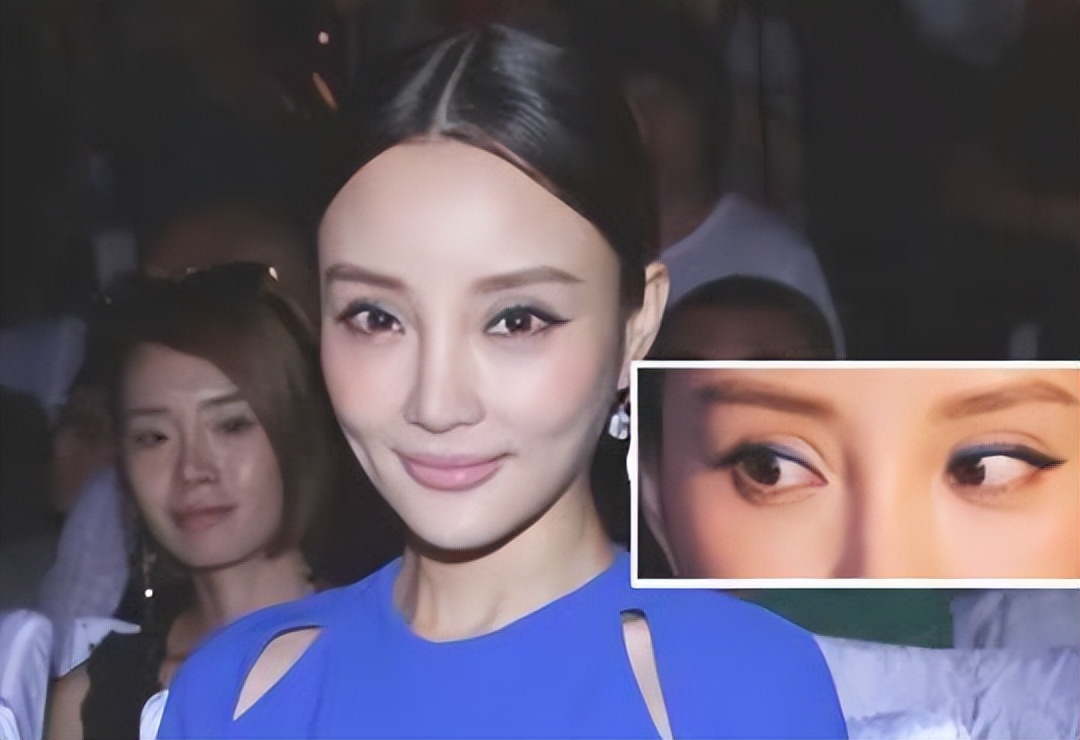 Li Xiaolu's eyelids were "sprayed" during plastic surgery, and there ...