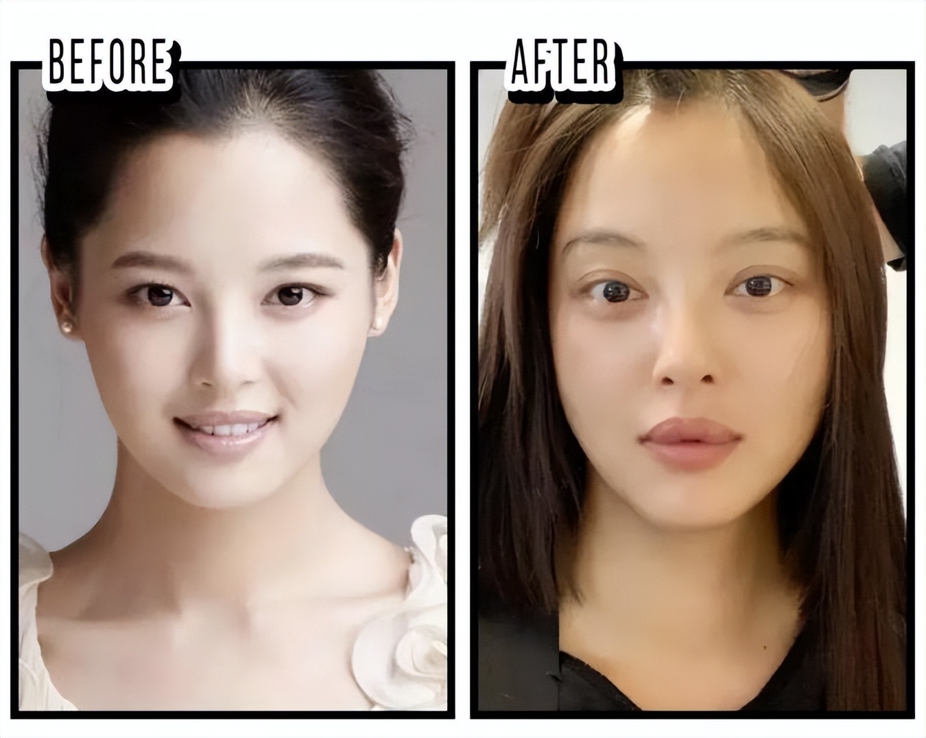 Acting actress Xin Zhilei's plain double eyelids have attracted ...