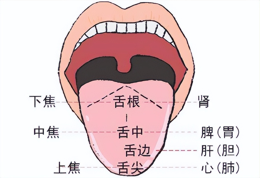 What's up with the cracked tongue?Where is the problem in the body?One ...