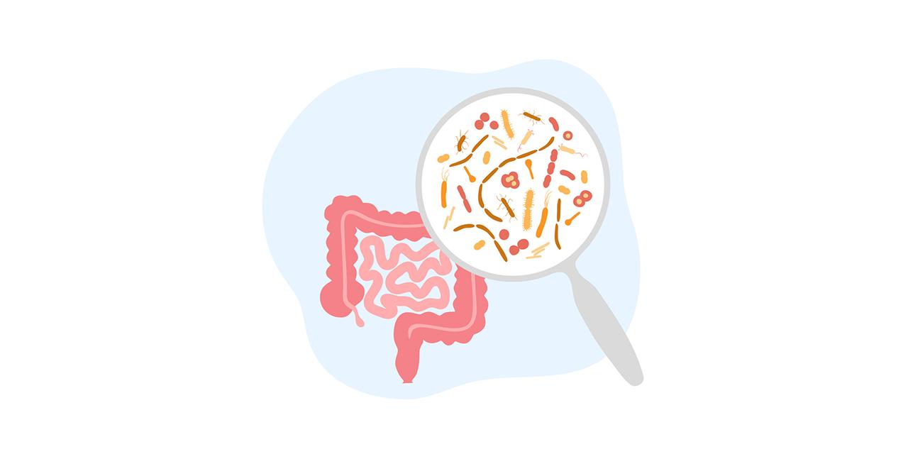 2 new studies: How to use diet-microbiota interaction to improve ...