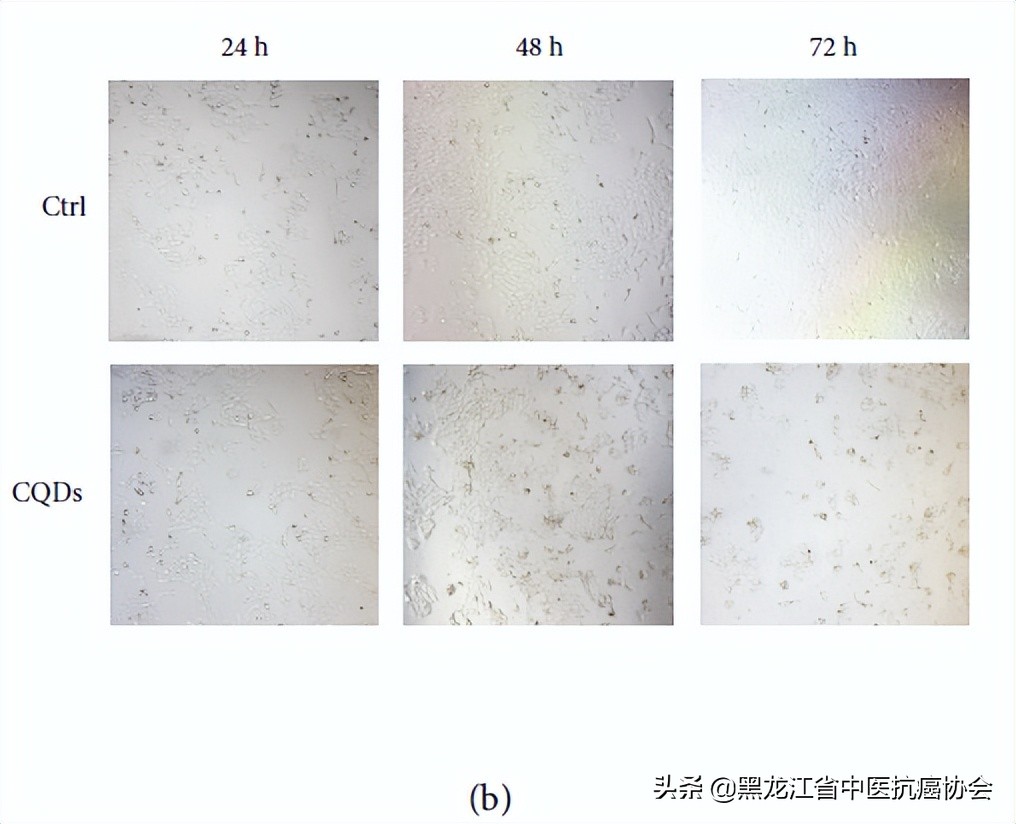 Carbon quantum dots trigger apoptosis in osteosarcoma 143B cell line ...