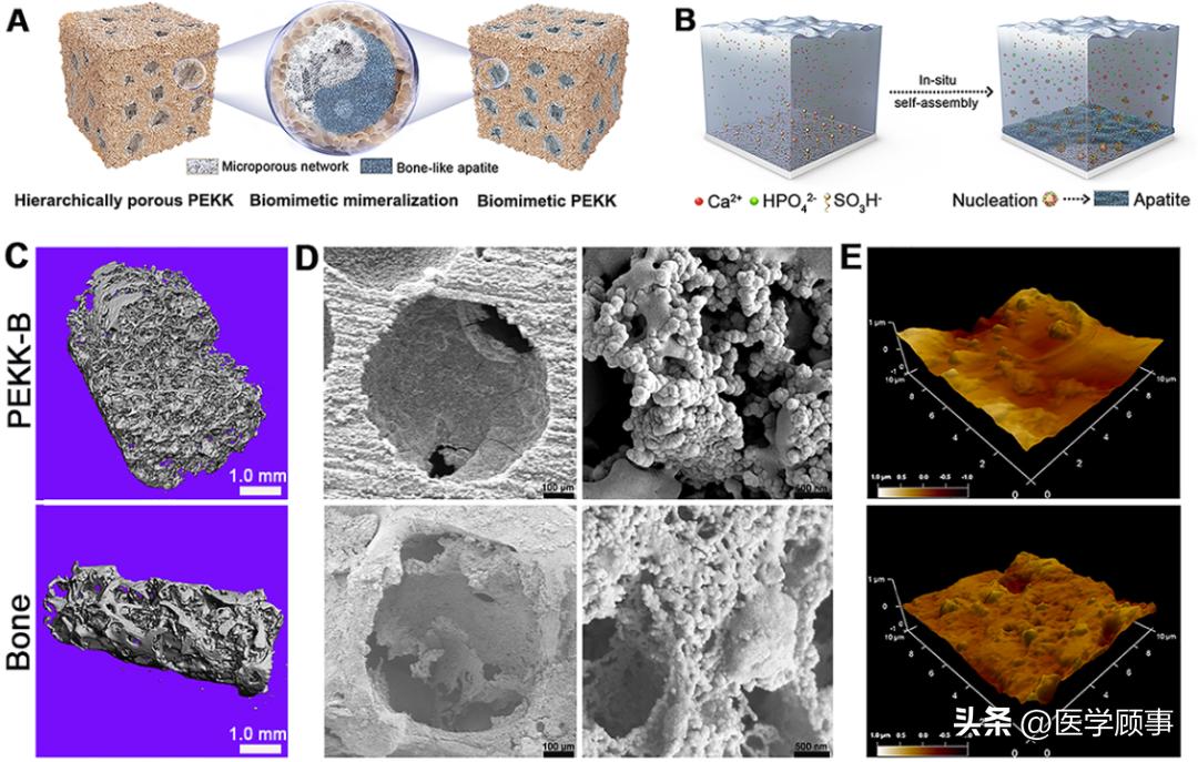 Academician Zhang Xingdong "Sci. Adv.": Bone regeneration induced by ...