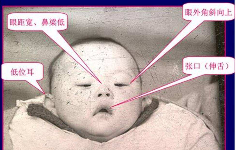 "Lion Boy" makes squinting Chinese confident? - iNEWS