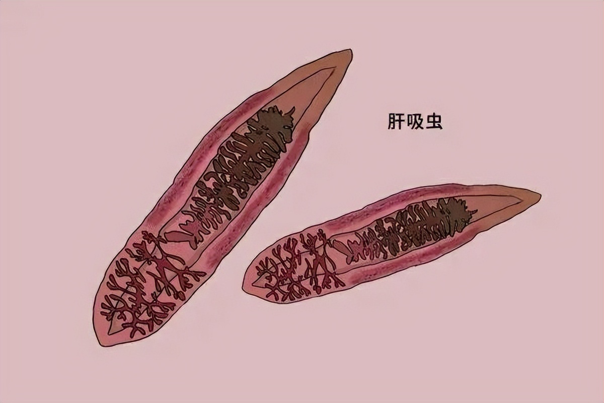 The five foods with the most parasites, how many have you eaten? - iNEWS