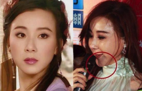 The 56-year-old Hong Kong star has severe hair loss, her hair is sparse ...