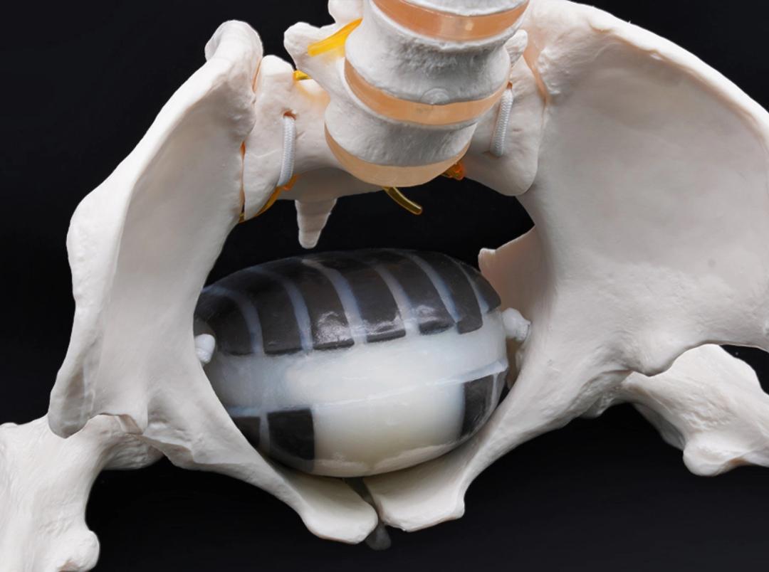 Science Advances: Implantable magnetically controlled soft robot ...