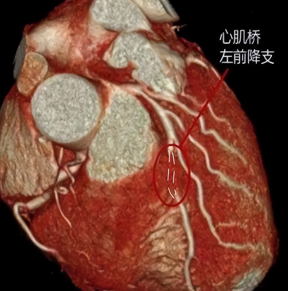 Have a "bridge" in your heart? - iNEWS