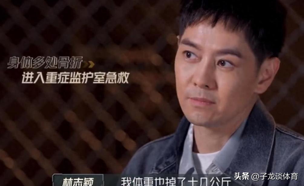 Jimmy Lin revealed his facial scars publicly for the first time after ...