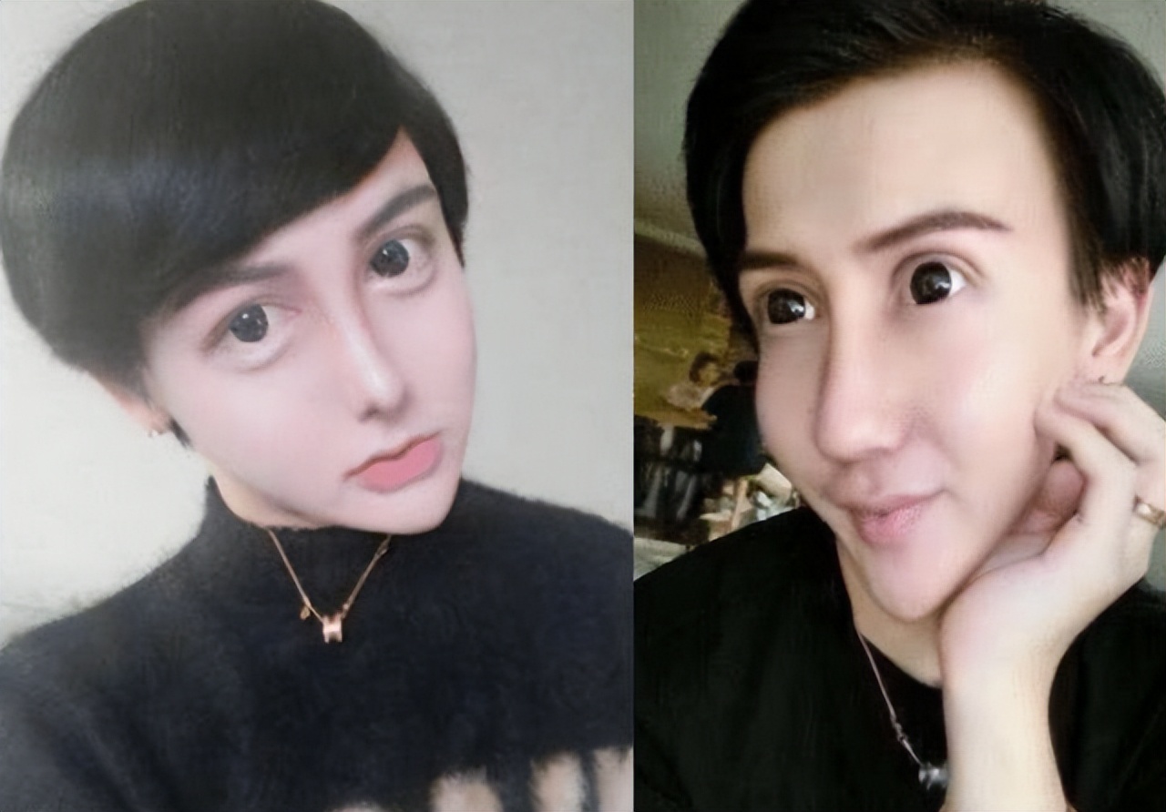 Artists fall in love with plastic surgery: It is very common to cut ...