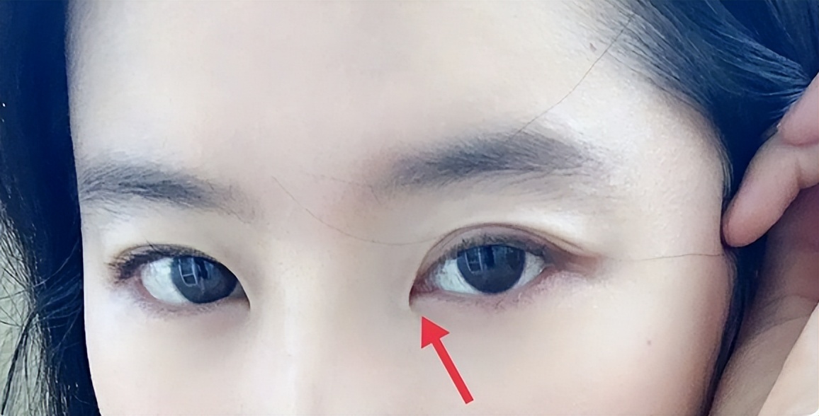 The weird "defects" of stars: protruding eyes, lack of God, cross-eyed ...