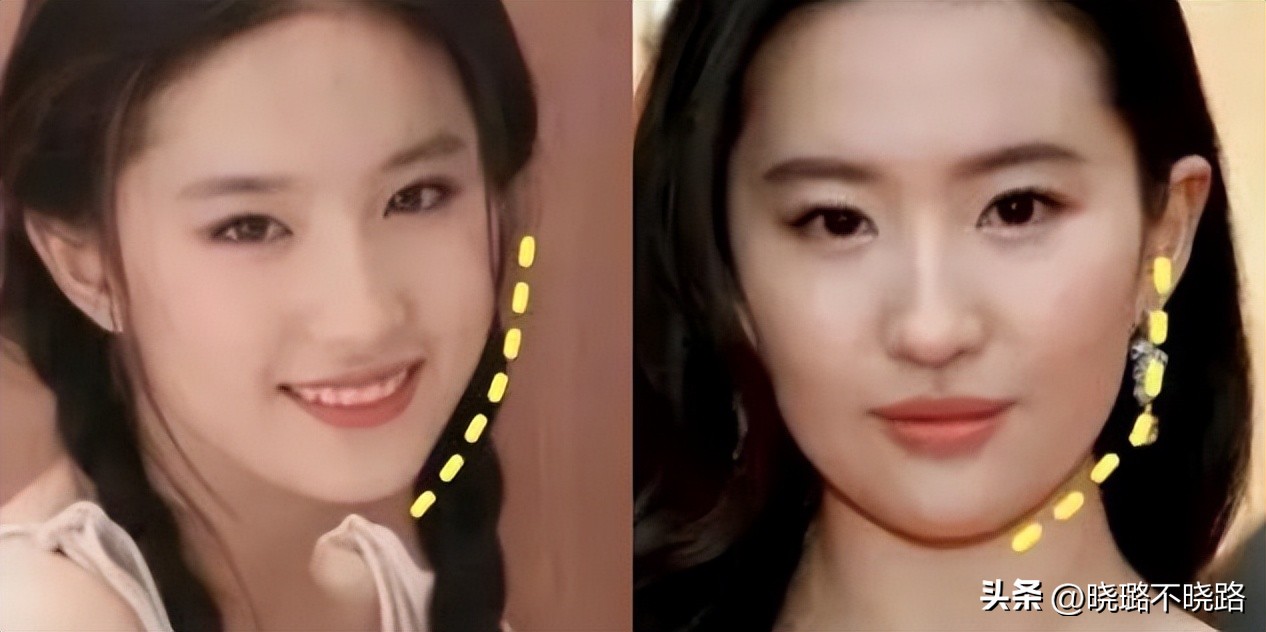 High cheekbones are really nothing, "fat cheeks" are the most "deadly ...