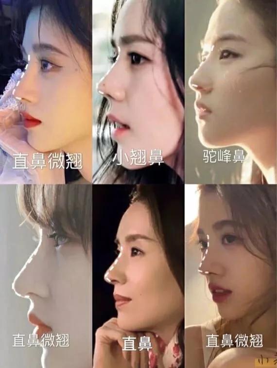 Why do some people have a high nose bridge, but they still don't look ...