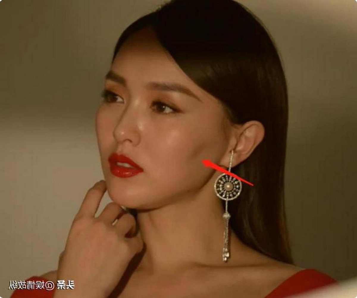 Protruding mouth, short chin, flat nose bridge, sunken face...The ...