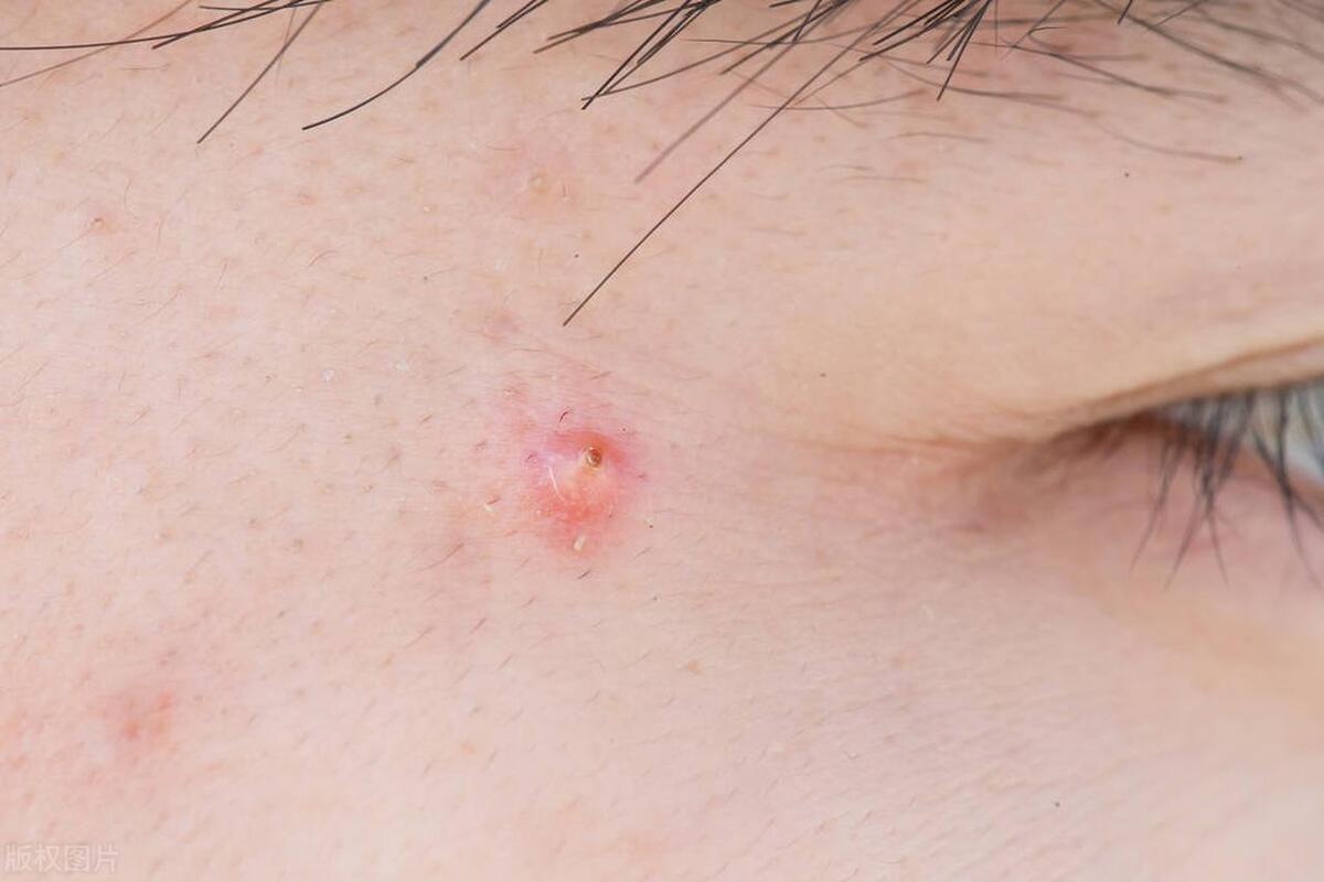 [Health Science] Do you know the difference between these 5 skin ...