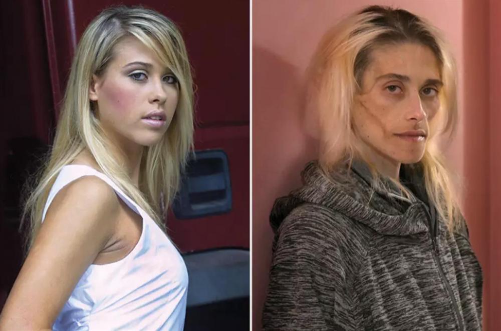 35-year-old model died of anorexia only 23 kg - iNEWS
