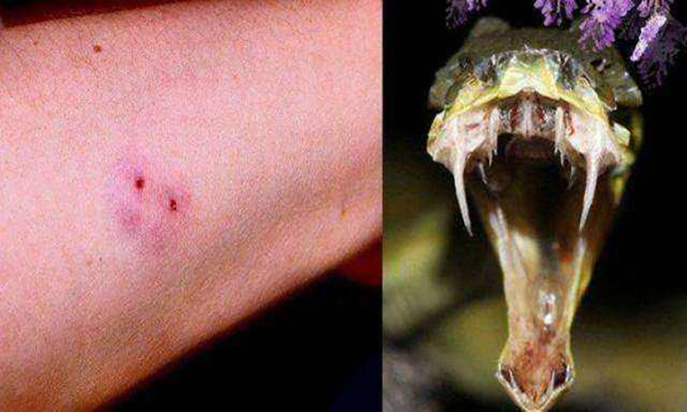 What are the common venomous snakes in rural areas?What does it look ...