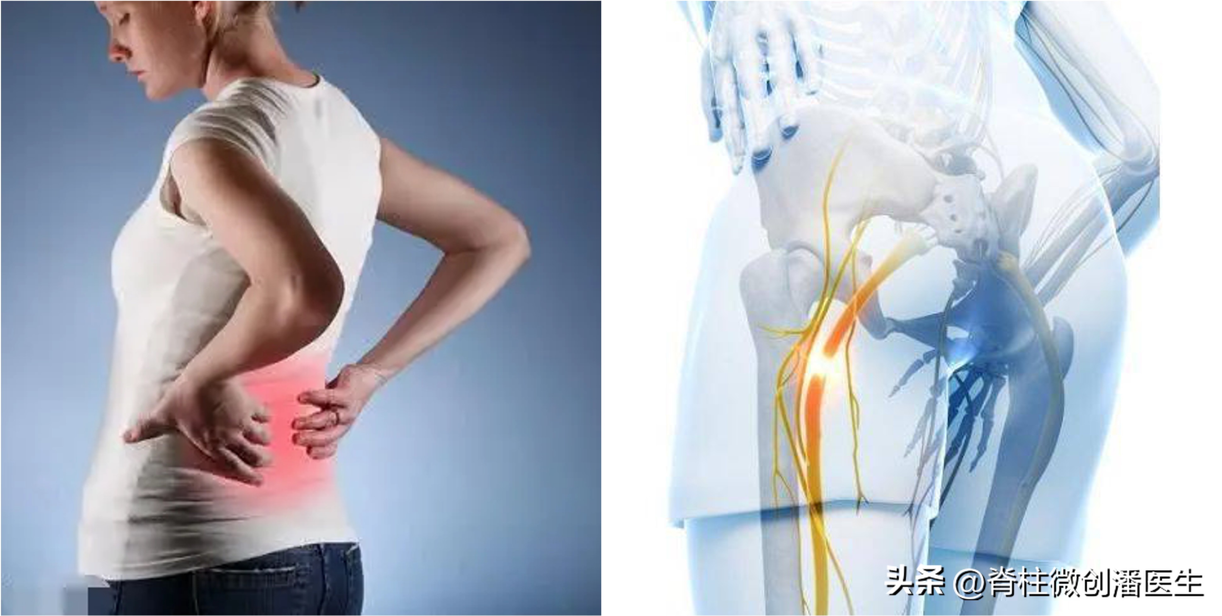 What problems will lumbar sacralization and sacral lumbarization cause ...