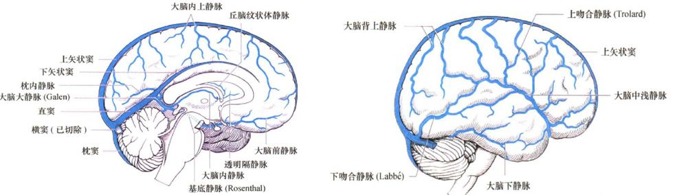 Anatomy and classification of cerebral venous thrombosis - iMedia