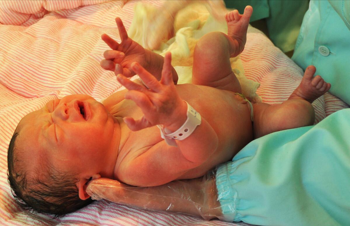 Why are newborns so ugly?There are 6 physiological phenomena at work ...