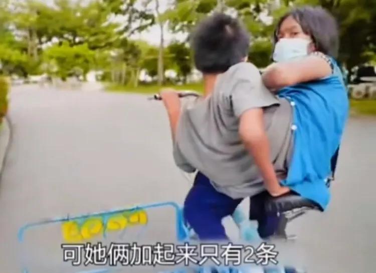 Rare conjoined twins in good condition - iNEWS