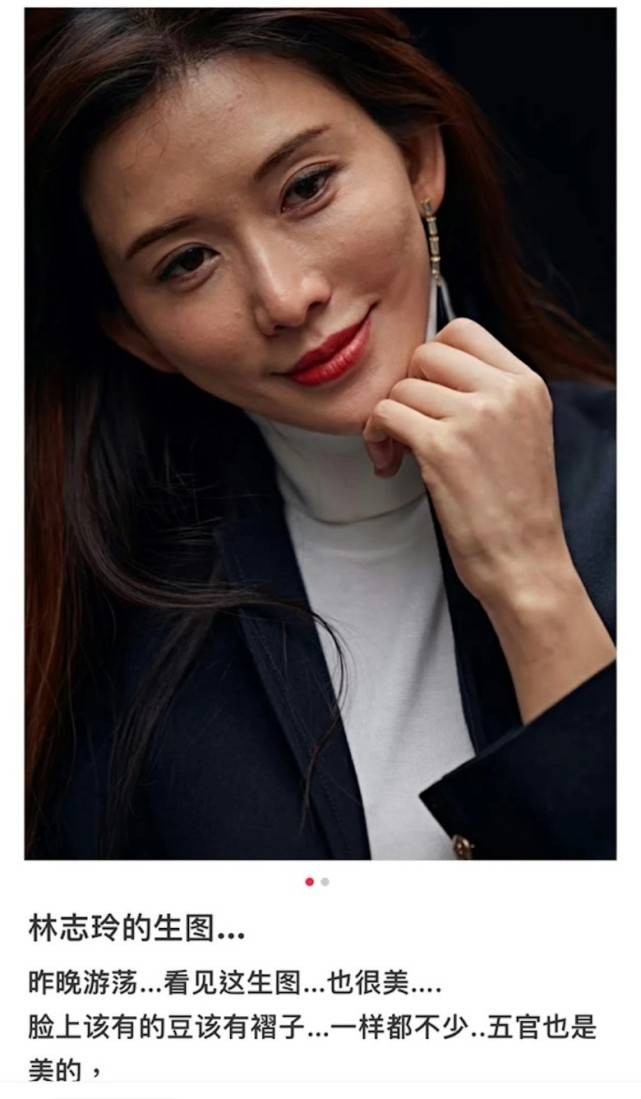 Goddess Lin Chiling's beauty is late, and the pimples and folds on her ...