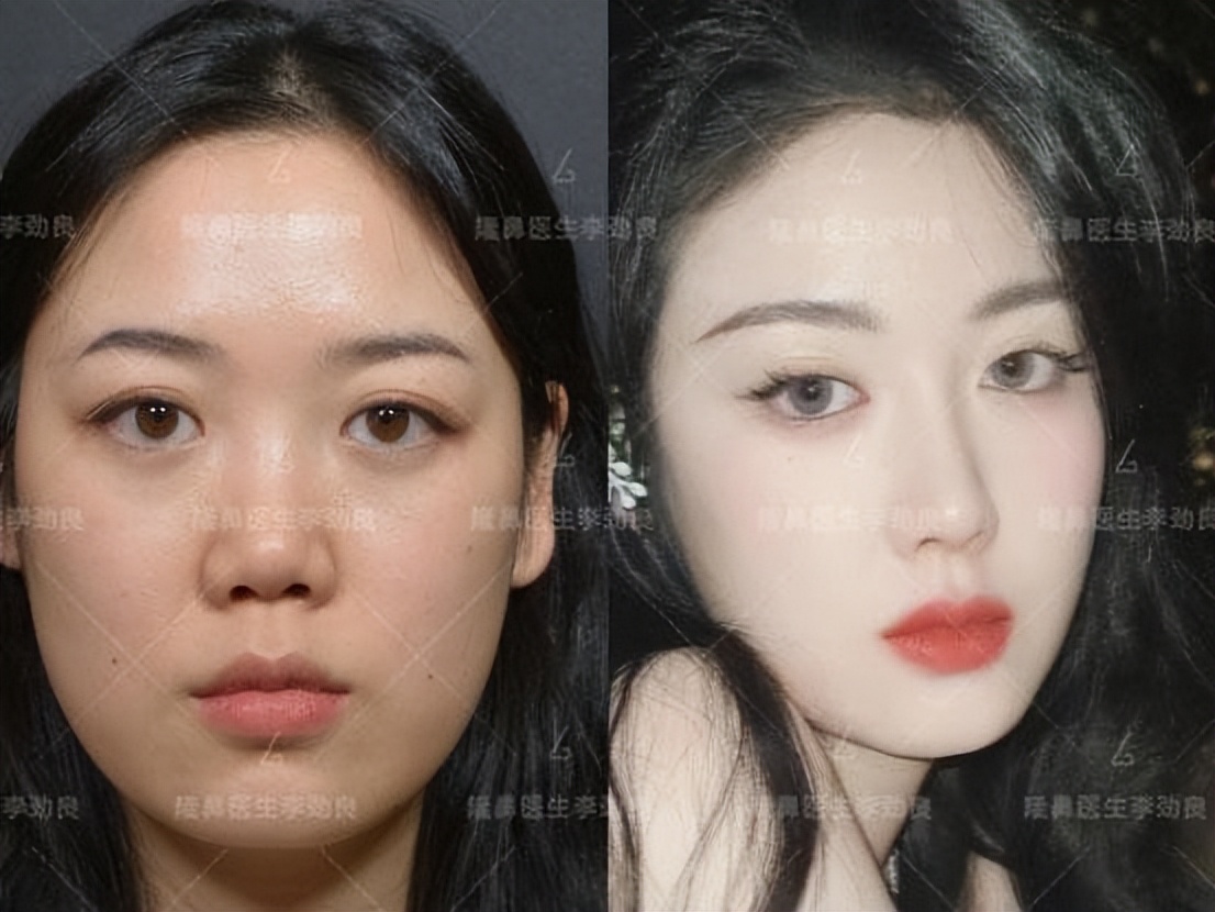 "Till The End Of The Moon" Luo Yunxi plastic surgery or skinny? This is ...