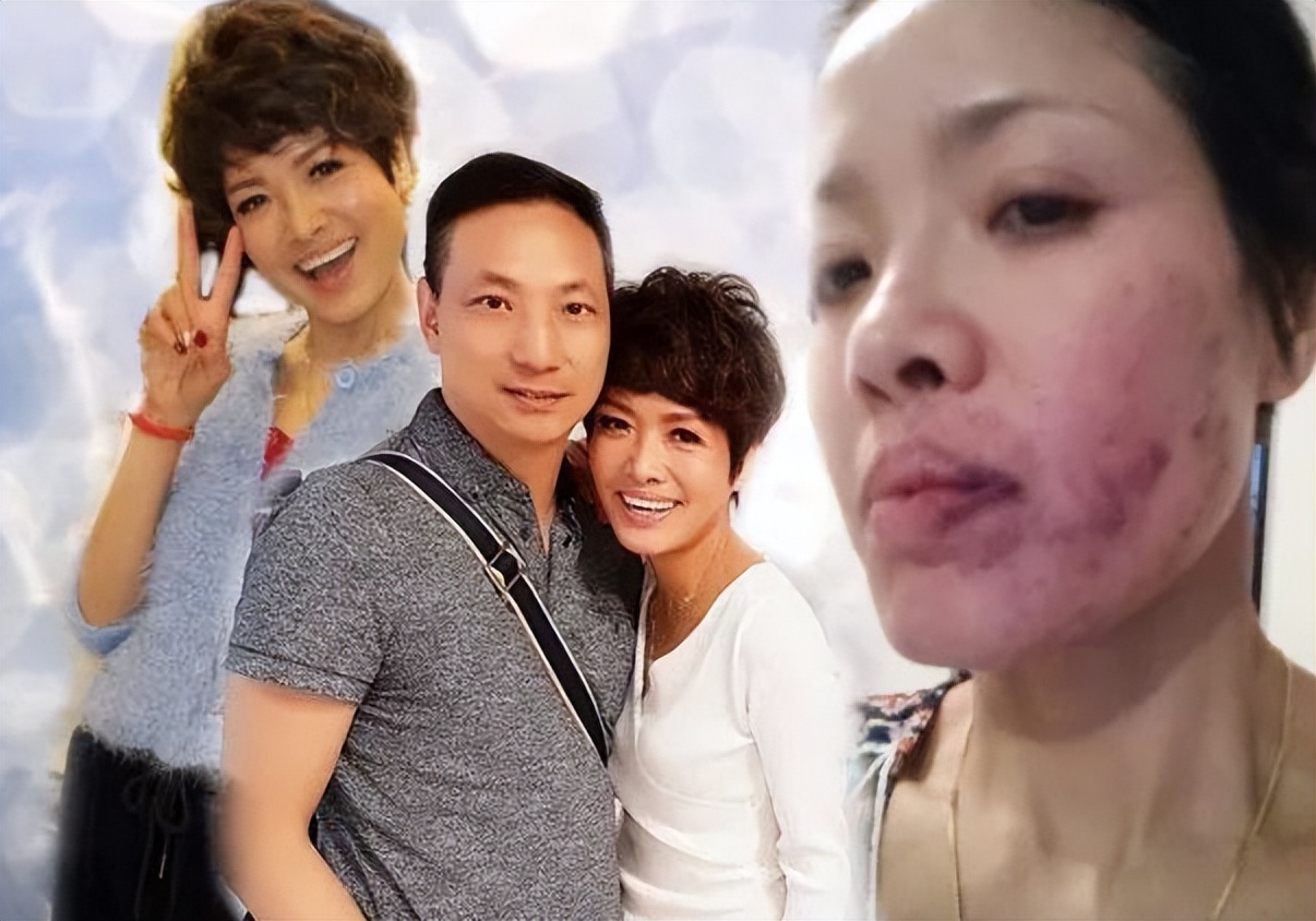 A well-known TVB actress was disfigured in a car accident and lost her ...