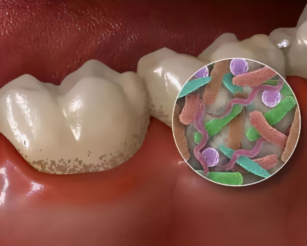 Why is something stinky from the teeth, but I can't smell it in my ...