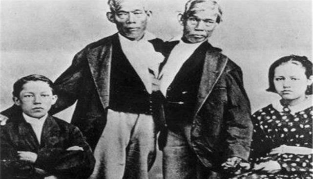 The Chinese Siamese brothers became famous for their performances ...