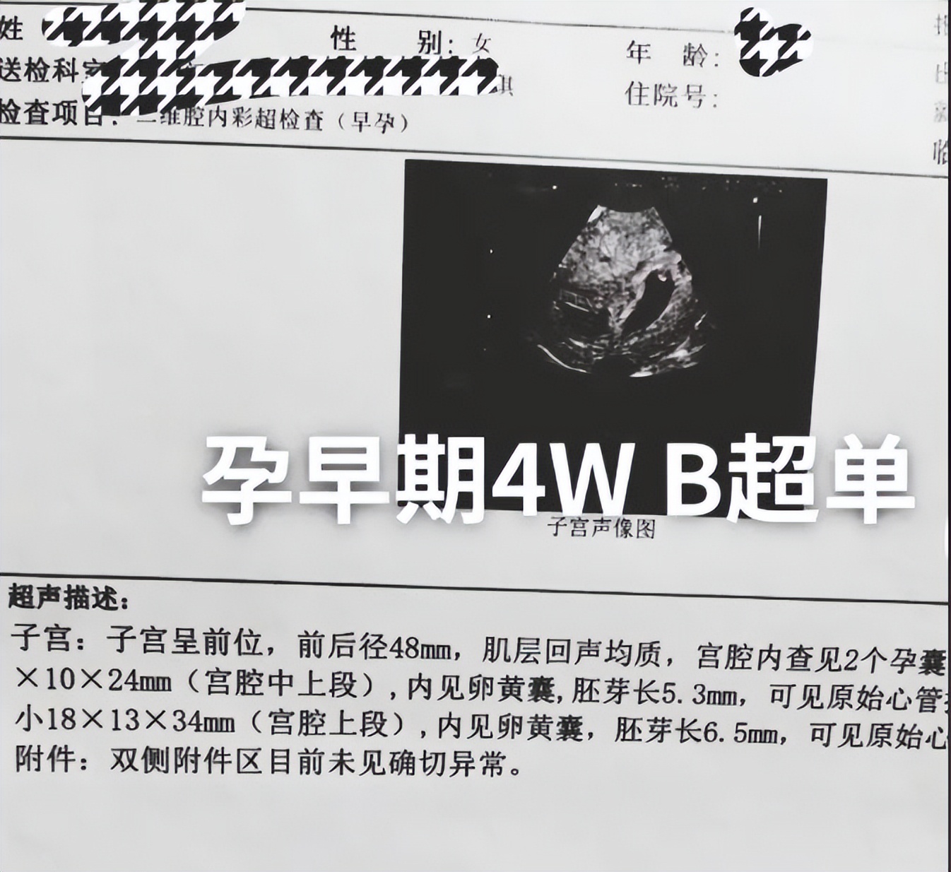 Chen Meng posted a color ultrasound report, which is a twin with double ...
