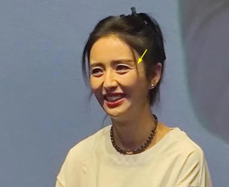 Tong Liya was in poor condition during her Chengdu road show, with ...
