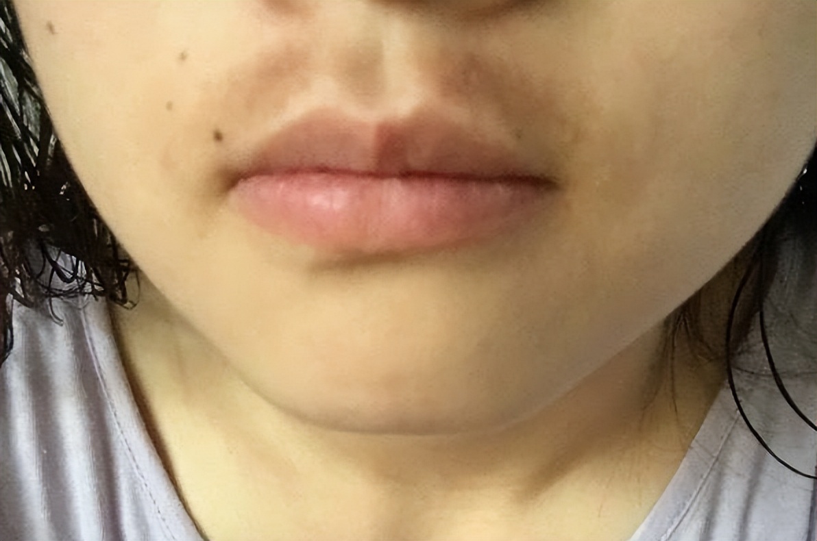 Look at lip color, know health: lips are the barometer of the body ...