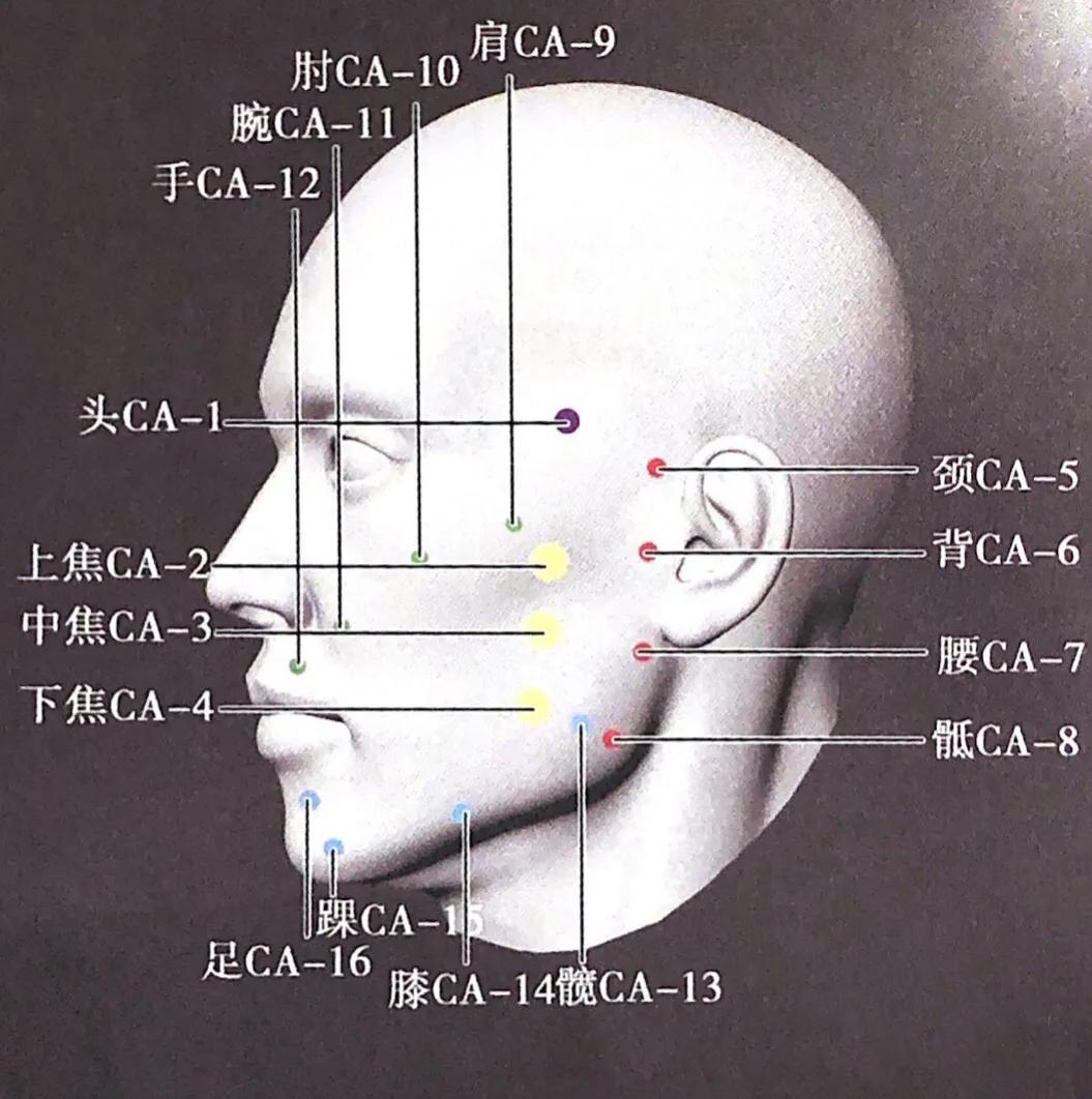 Acute and chronic pain conditioning - buccal acupuncture - iNEWS
