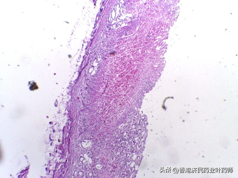 Omeprazole innovative oral liquid formulation!Konvomep approved for ...