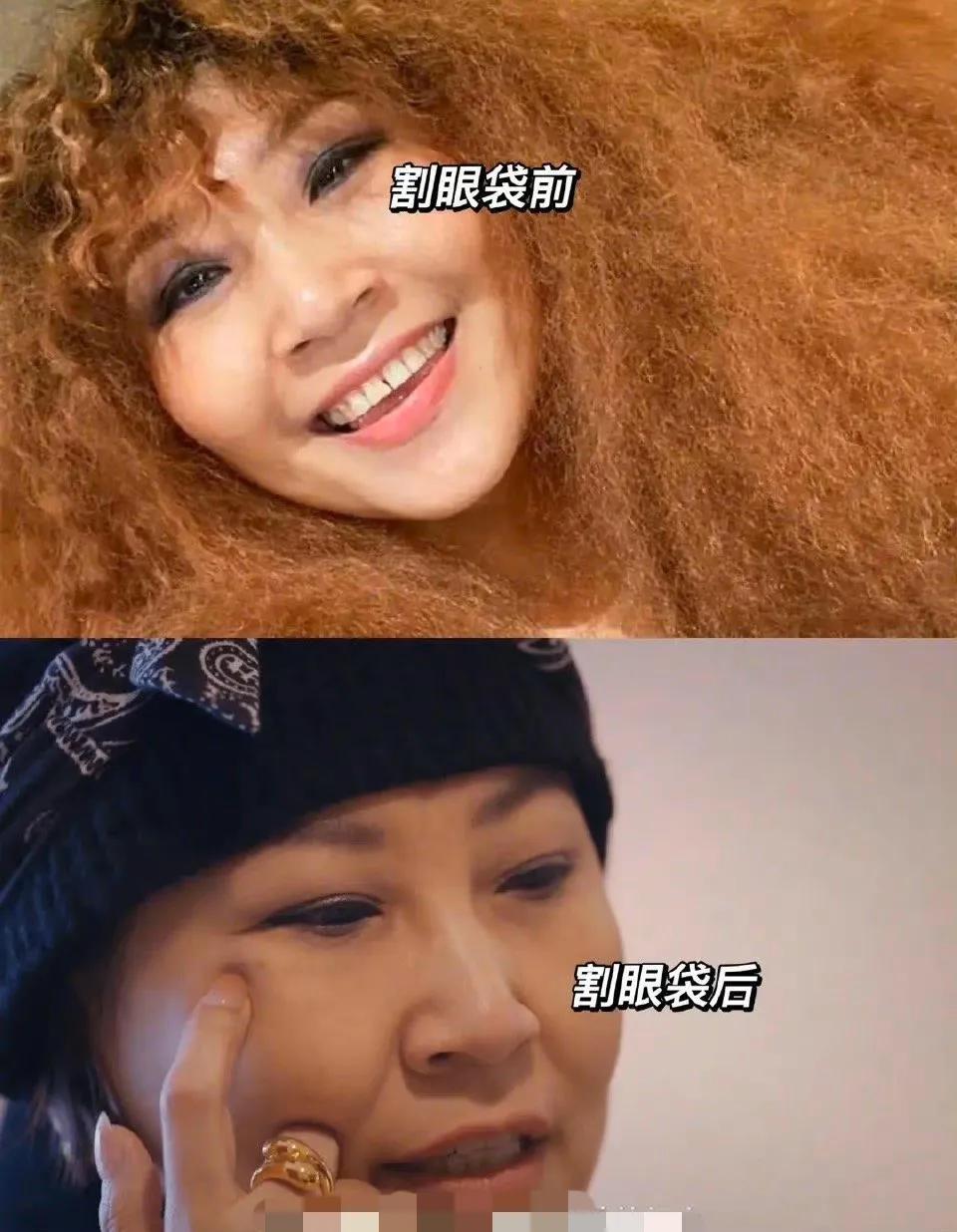 After the failure of plastic surgery, she chooses to grow old calmly ...