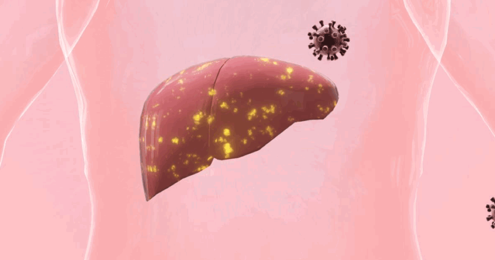 Whether the liver is good, you can tell by looking at the palm of your ...