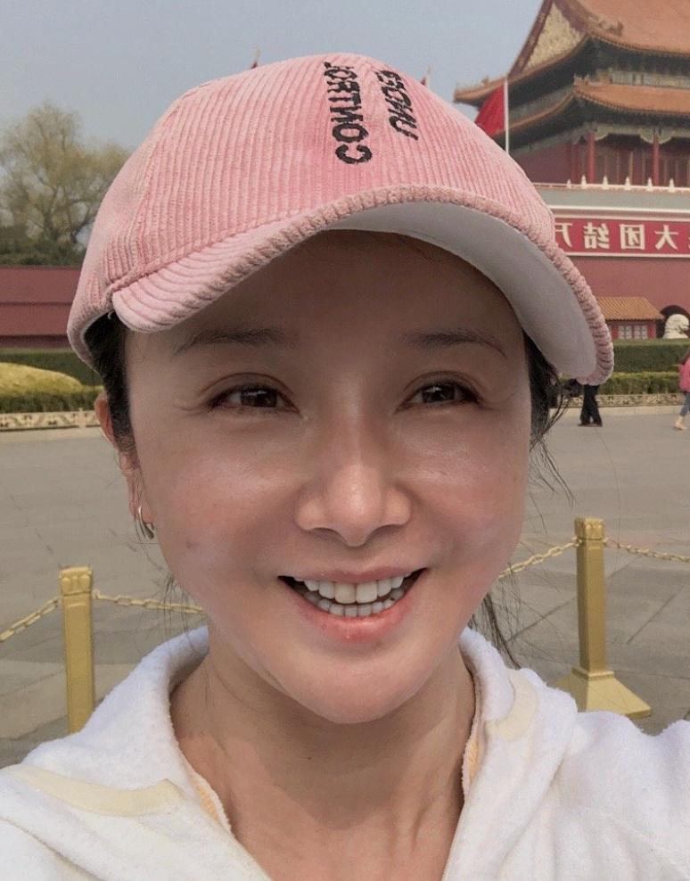 The face is unnatural, but the chin can plow the land? Actress plastic ...