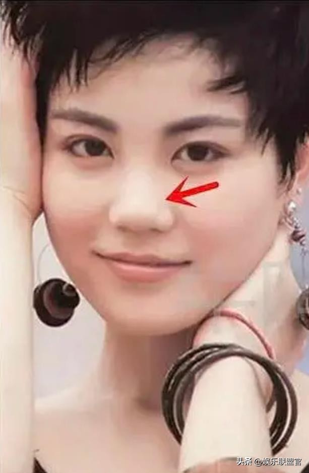 She looks fair and beautiful, but she loses to "ugly nose". The noses ...