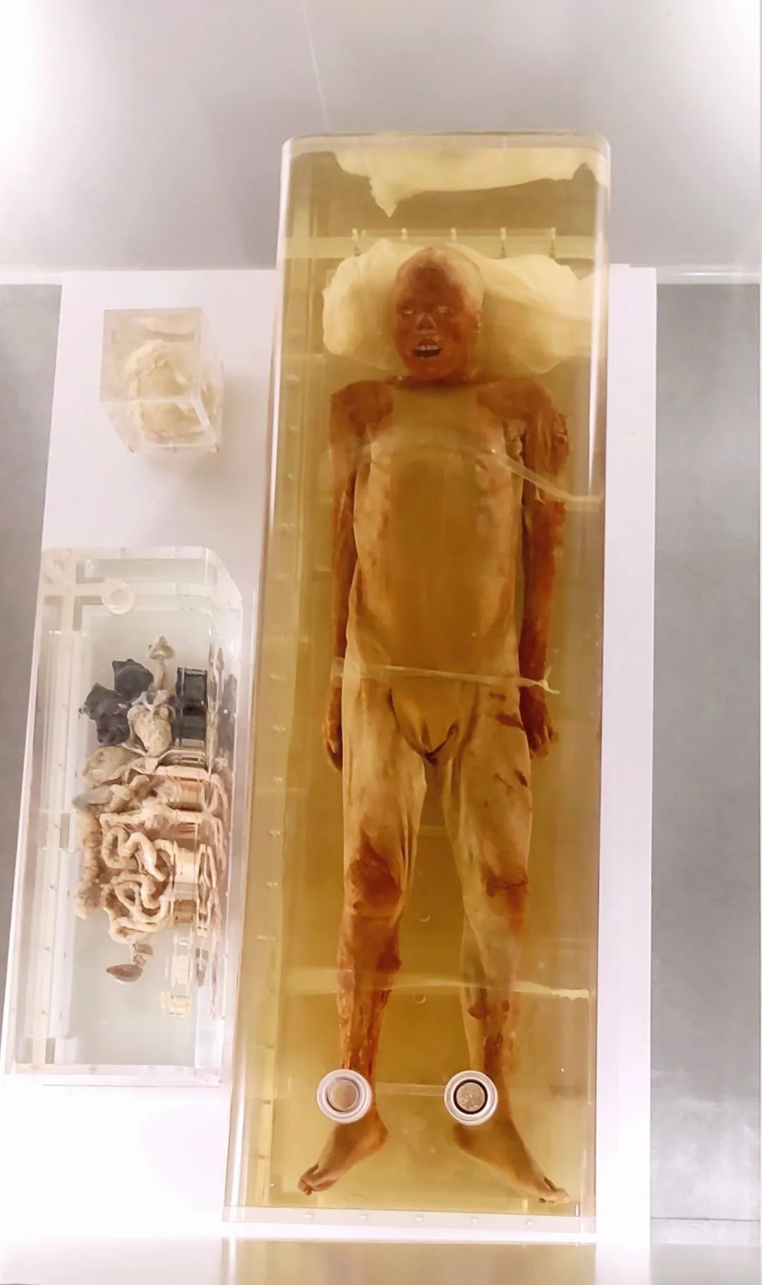 Jingzhou's well-preserved ancient corpses of more than two thousand ...