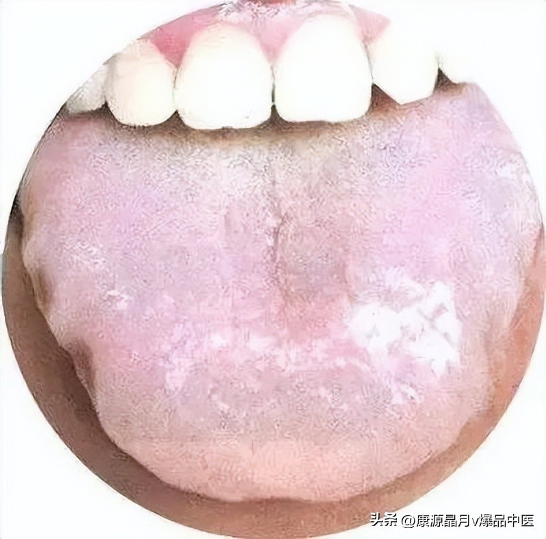 Precious tongue diagnosis map - iNEWS