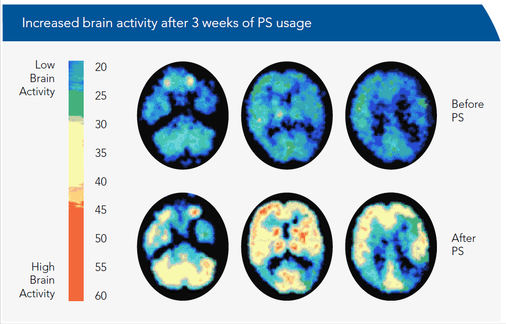 Stress, anxiety, memory loss, try brain aging PS, bring together 7 ...