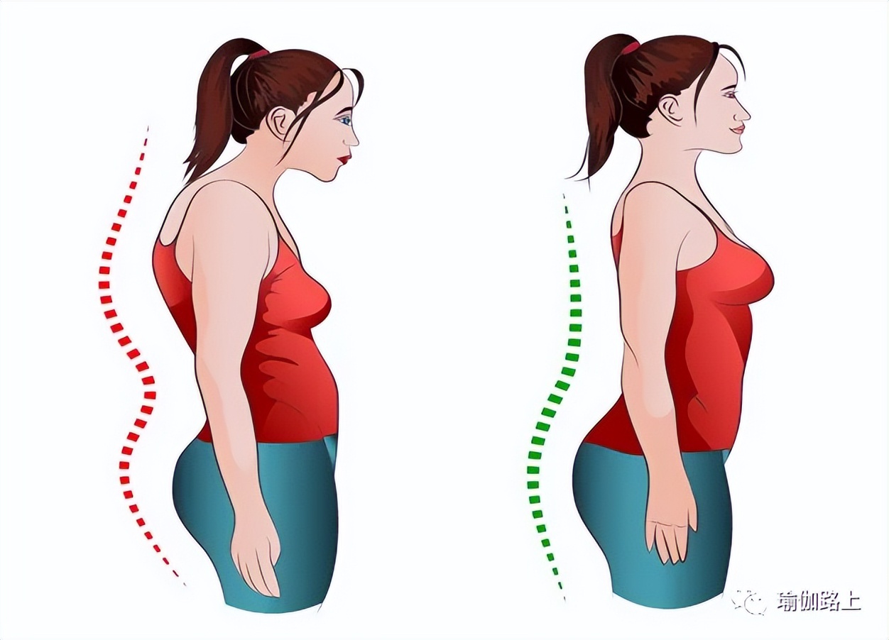5 Yoga Poses To Say Goodbye To Round Shoulders And Hunchback Inews