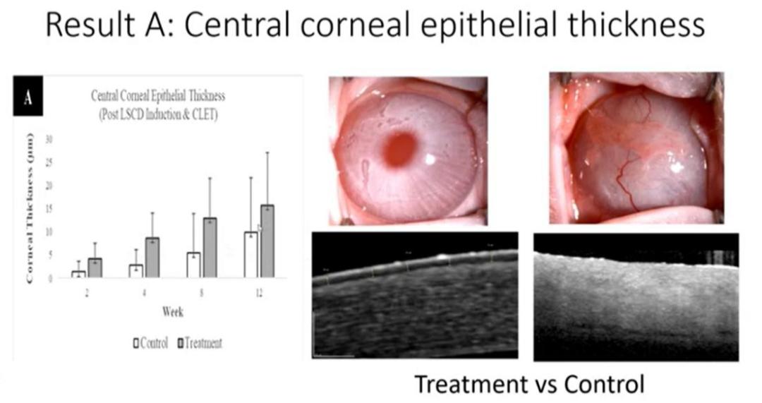 A New Approach to Treat Corneal Blindness Caused by Limbal Stem Cell ...